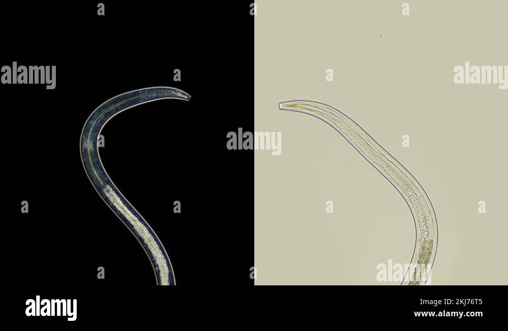 A nematoda worm under a microscope, there are free-living, commensals ...