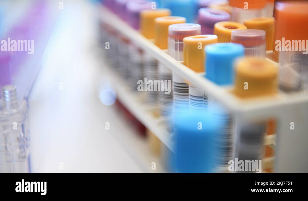 Haematology pathology Stock Videos & Footage - HD and 4K Video Clips ...