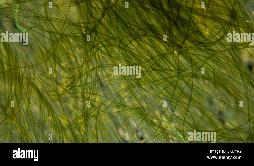 Green algae of the cyanobacteria Oscillatoria under the microscope, the ...