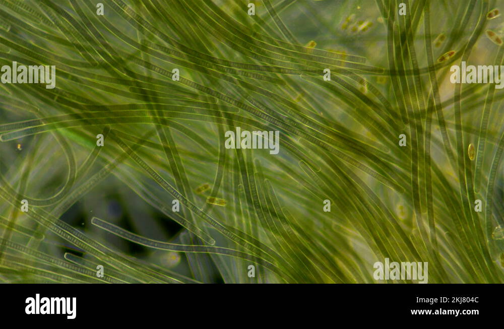 Green algae of the cyanobacteria Oscillatoria under the microscope, the ...