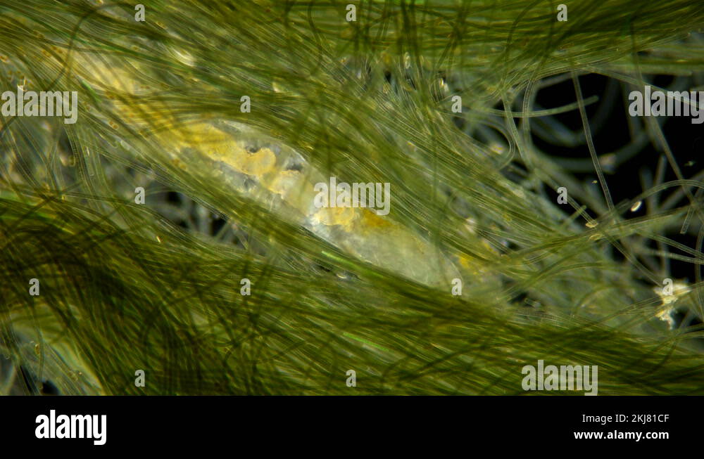 worm Nais sp. under a microscope, the Tubificidae family, a subclass of ...