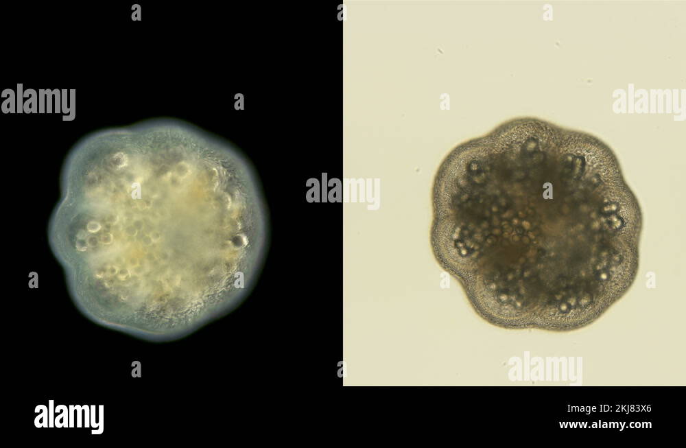 coral larva under a microscope, Order: Actiniaria, Phylum: Cnidaria ...