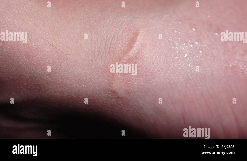 Cut arm by accident Stock Videos & Footage - HD and 4K Video Clips - Alamy