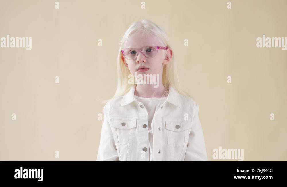 little fashion model, kid girl with abnormal deviations, unusual ...