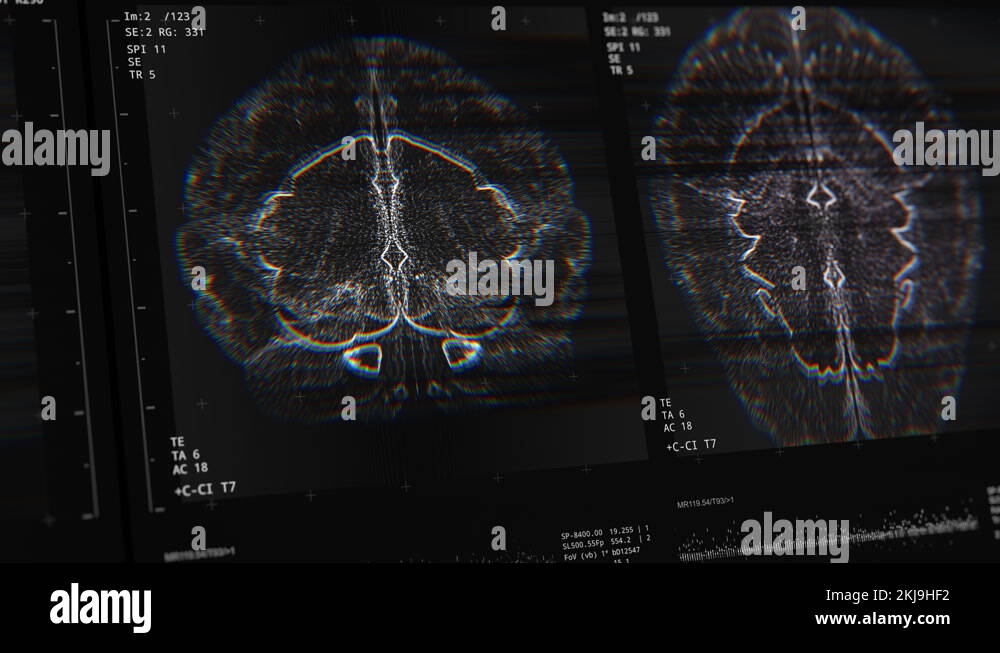 Brain scan screen animation. The device scans and displays vital signs ...