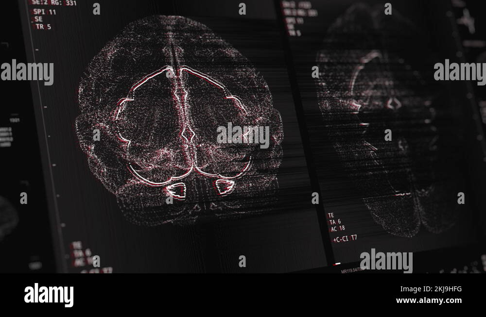 Brain scan screen animation. The device scans and displays vital signs ...