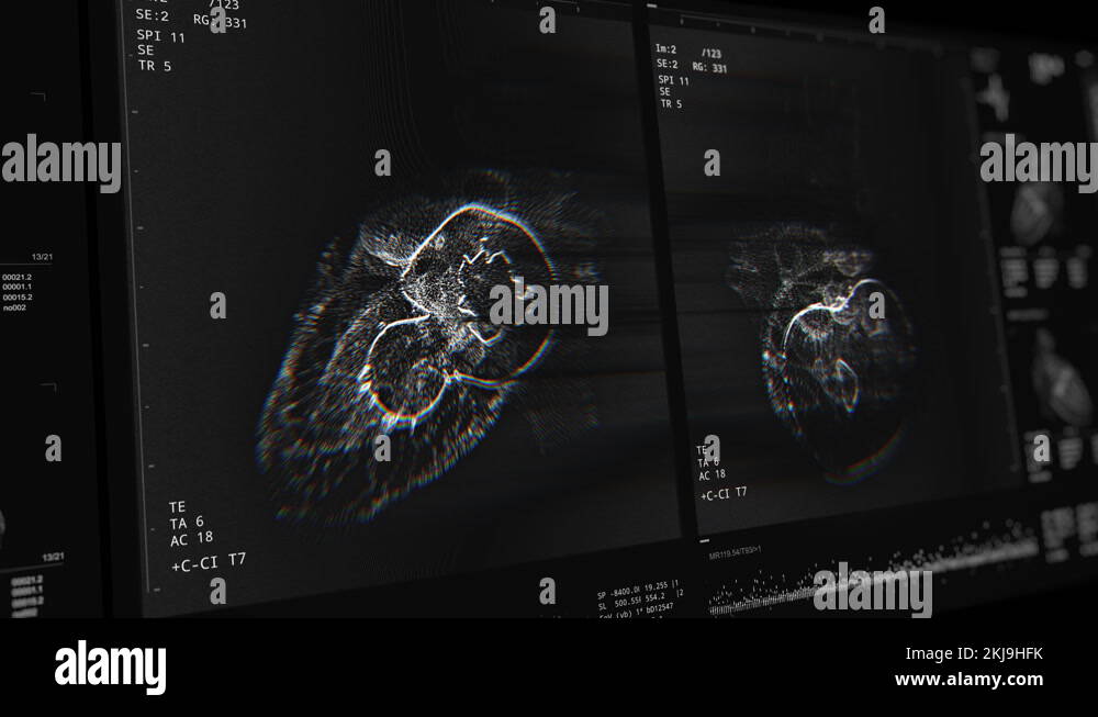 Heart scan screen animation. Health data. Diagnosis of diseases Stock ...