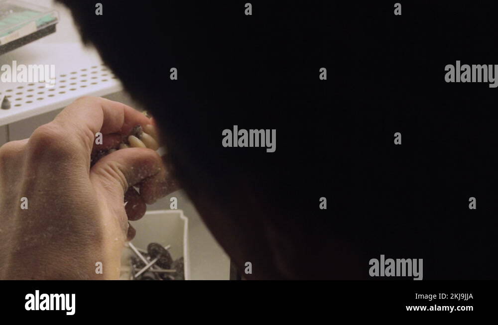 Finishing And Polishing Screw Retained Dental Restoration With Soft ...