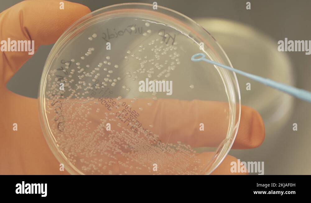 Transferring MRSA bacteria colony growth from one Petri dish to another ...