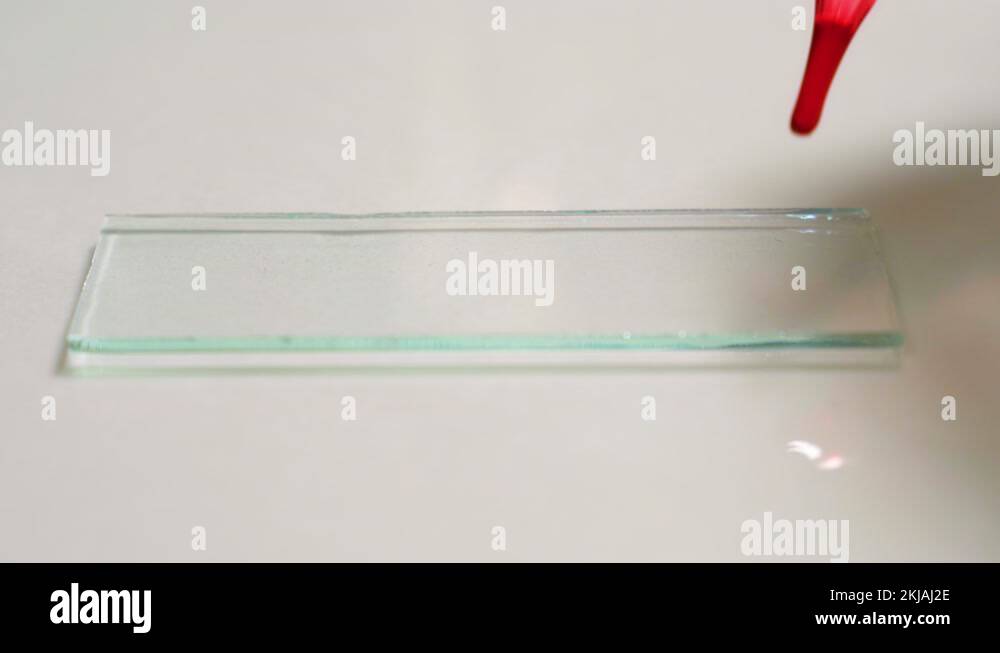 Dripping blood on the glass plate and smearing of sample. Blood test of ...