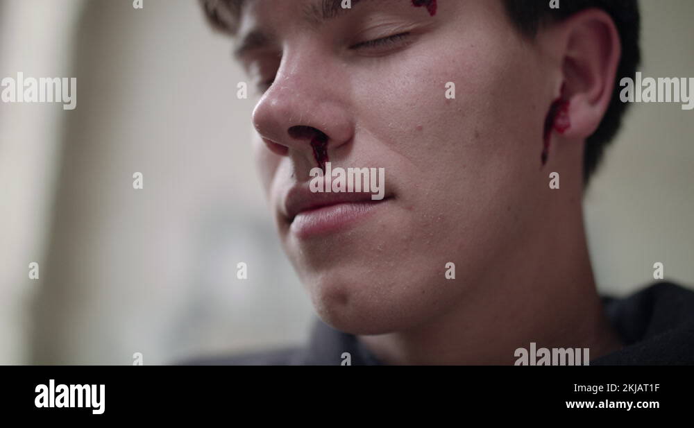 Close portrait of wounded, bloodied man looking shockingly at the ...