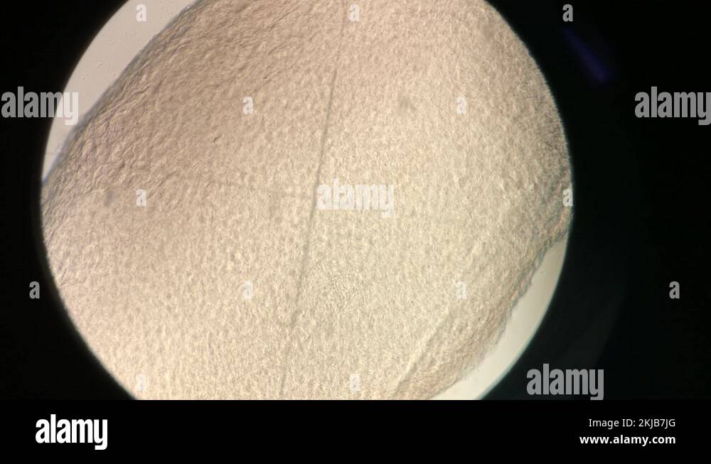 Human skin microscope Stock Videos & Footage - HD and 4K Video Clips ...