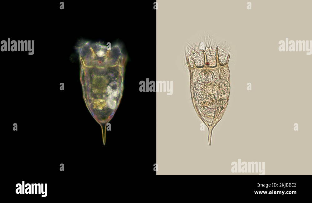 Plankton rotifers Rotifera Keratella Cochlearis Stock Video Footage - Alamy
