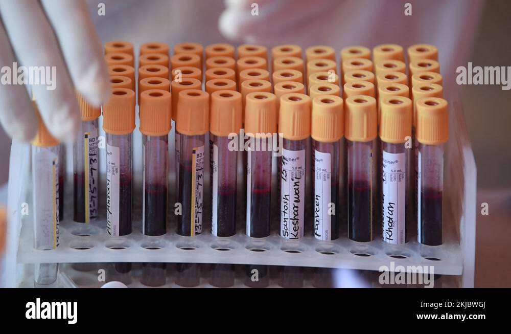 Blood collection centre Stock Videos & Footage - HD and 4K Video Clips ...