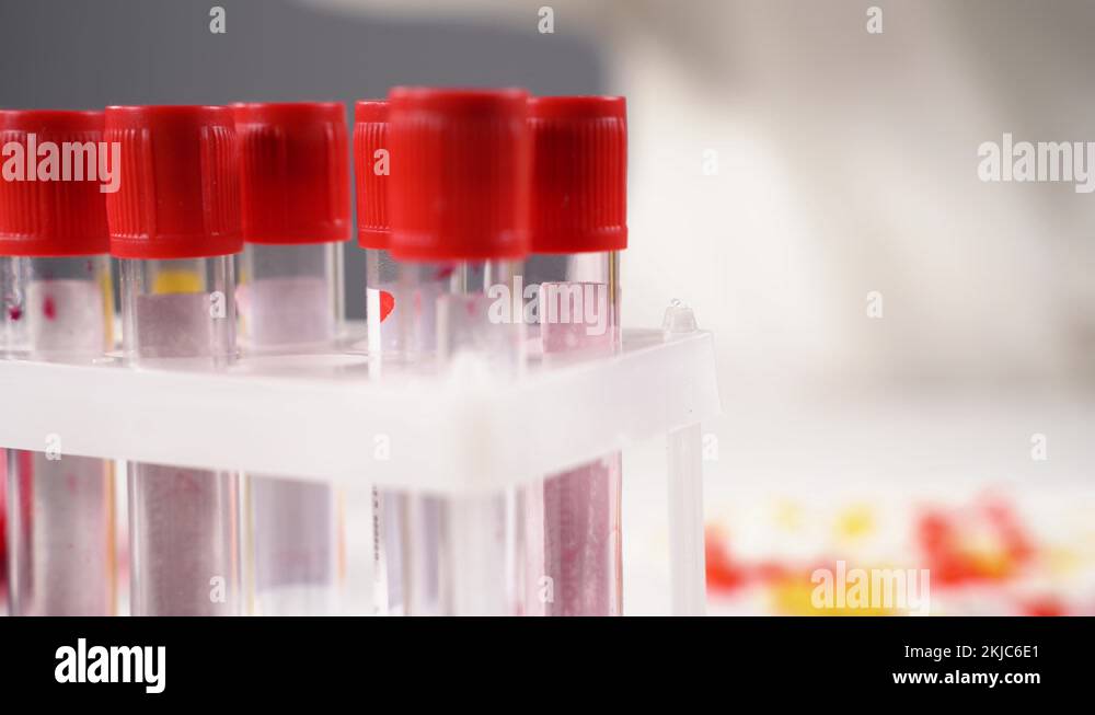 Stand with blood sample test tubes in research medical laboratory. Test ...