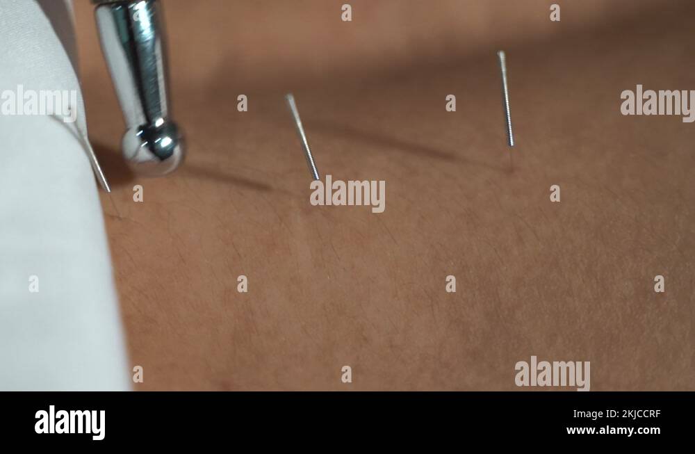 Acupuncturemodel Stock Videos & Footage - HD and 4K Video Clips - Alamy
