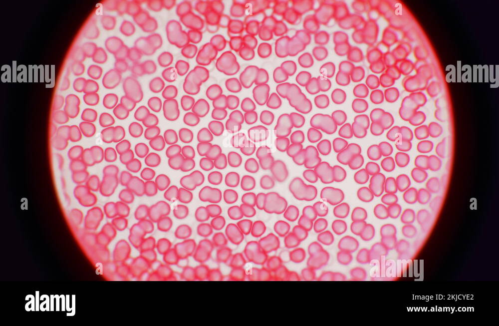 Blood cells and platelets Stock Videos & Footage - HD and 4K Video ...