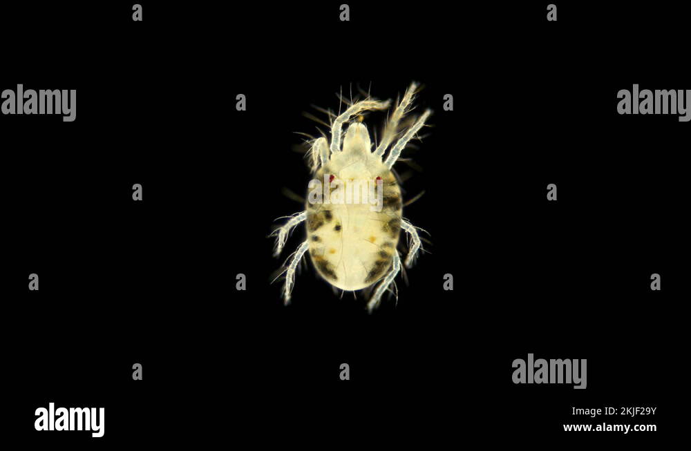 An ordinary spider mite under a microscope, the Tetranychidae family ...