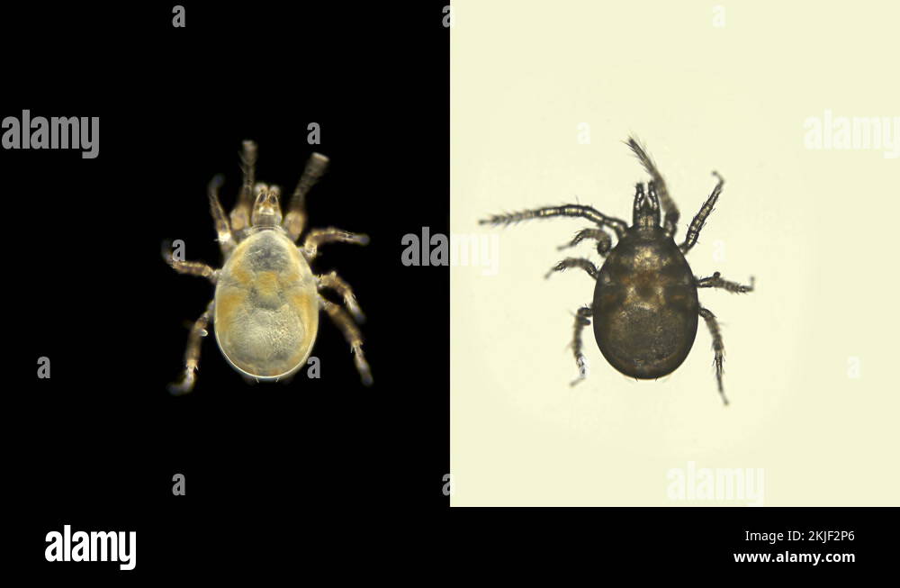 Acari(mite) under a microscope, order of the Mesostigmata Stock Video ...