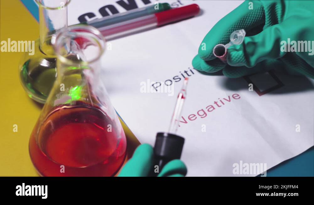 Clinical Diagnostic Of A Blood Sample With Specimen Of An Infection ...