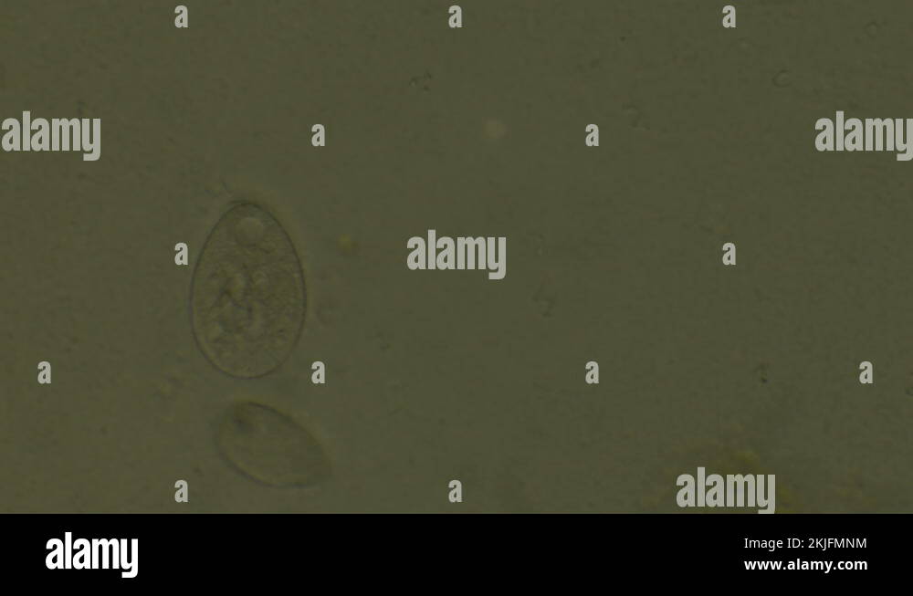 Microscopy of protozoa microorganisms in the water, showing ciliates ...
