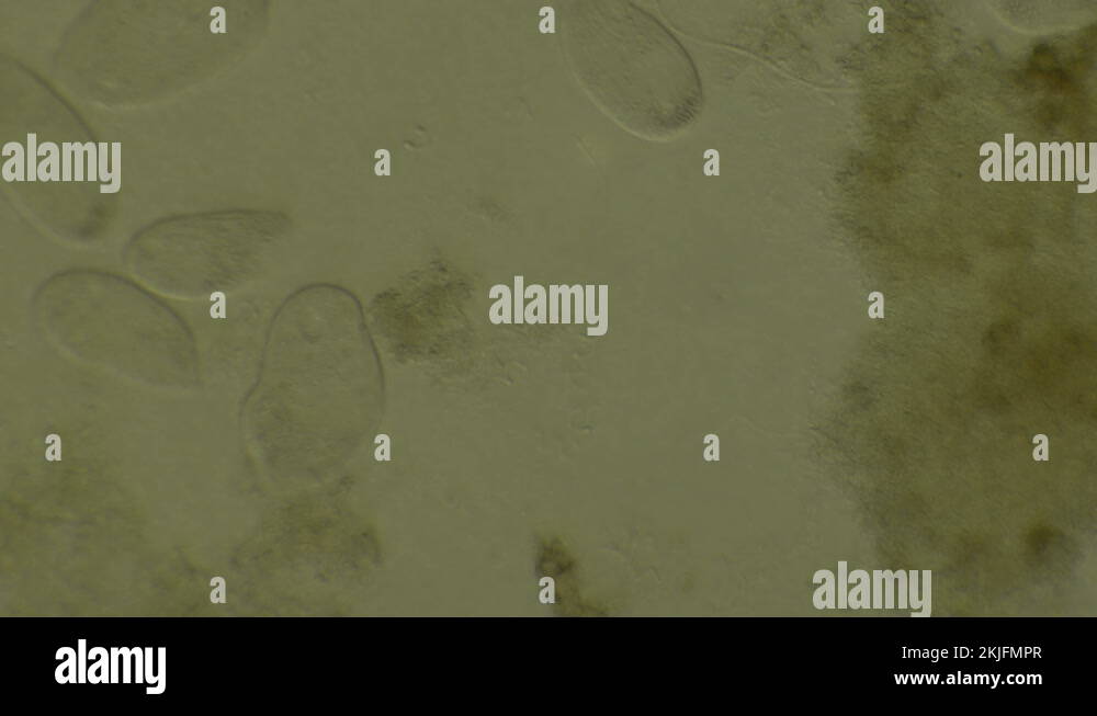 Microscopy Of Protozoa Microorganisms In The Water Showing Ciliates