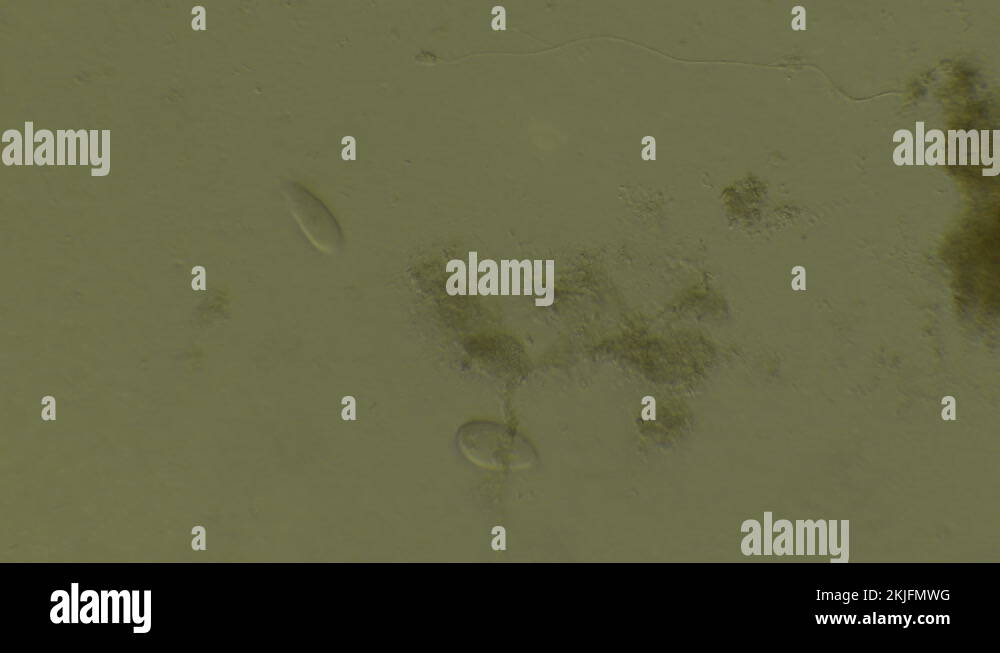 Microscopy of protozoa microorganisms in the water, showing ciliates ...