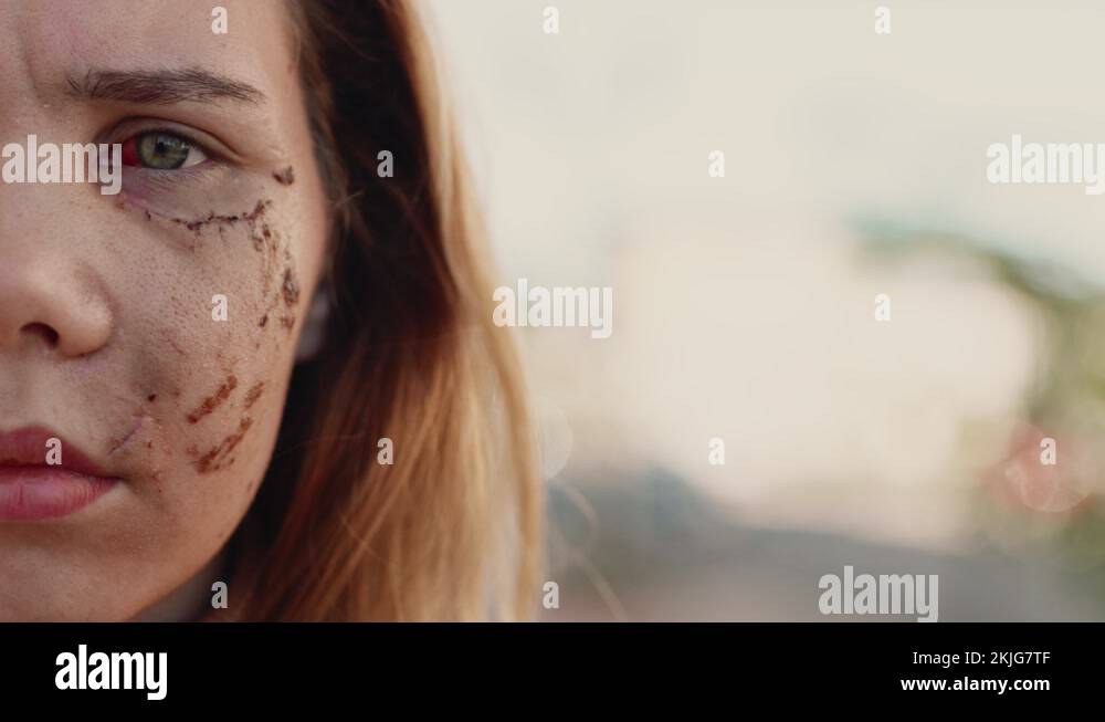 Young woman half portrait with scar on her face. Home violence victim ...