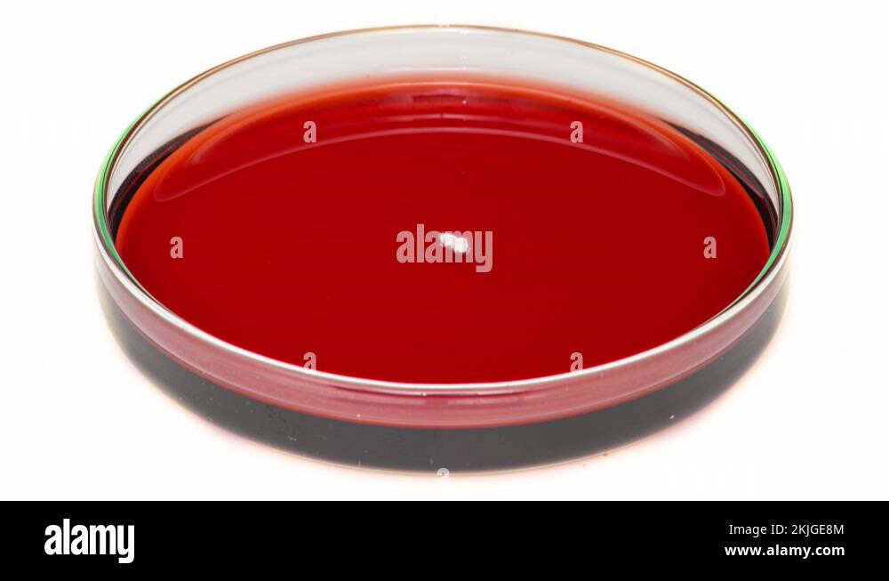 Experiments on the development of GMO bacteria decomposing plastic ...
