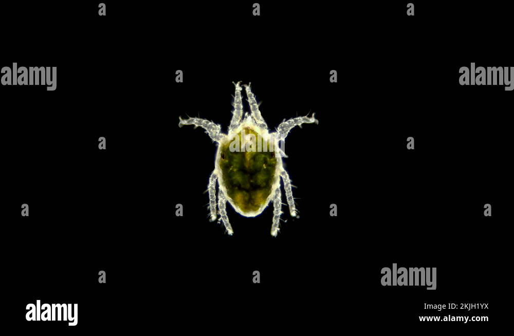 Tick(mite) living in water under a microscope, the superfamily ...