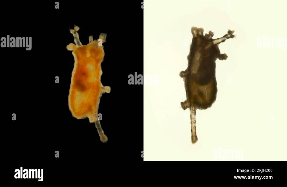 Pentacula Holothuroidea larva under the microscope, a type of ...