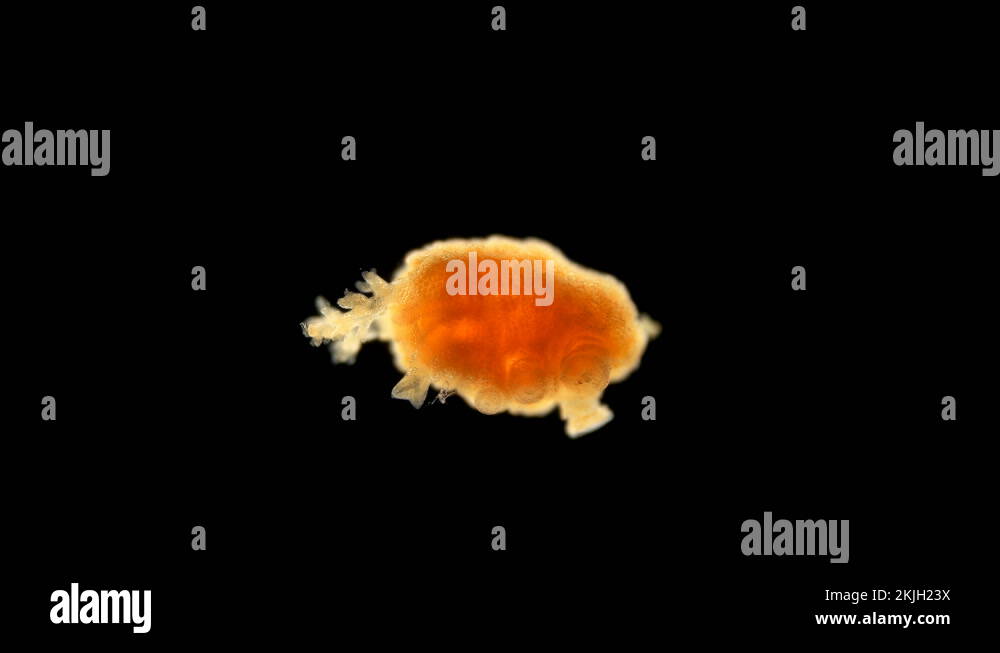 Pentacula Holothuroidea larva under the microscope, a type of ...
