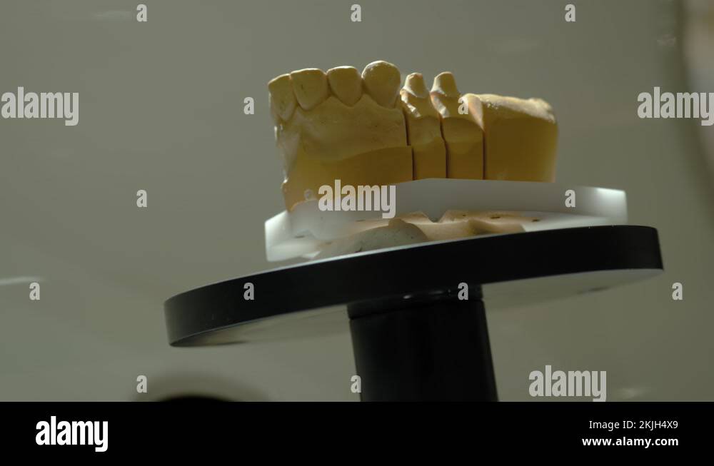 3D dental scanner for dental gypsum model scanning and measuring ...