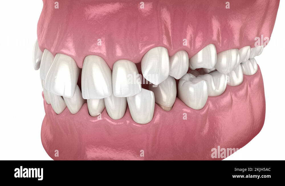 Position process Stock Videos & Footage - HD and 4K Video Clips - Alamy