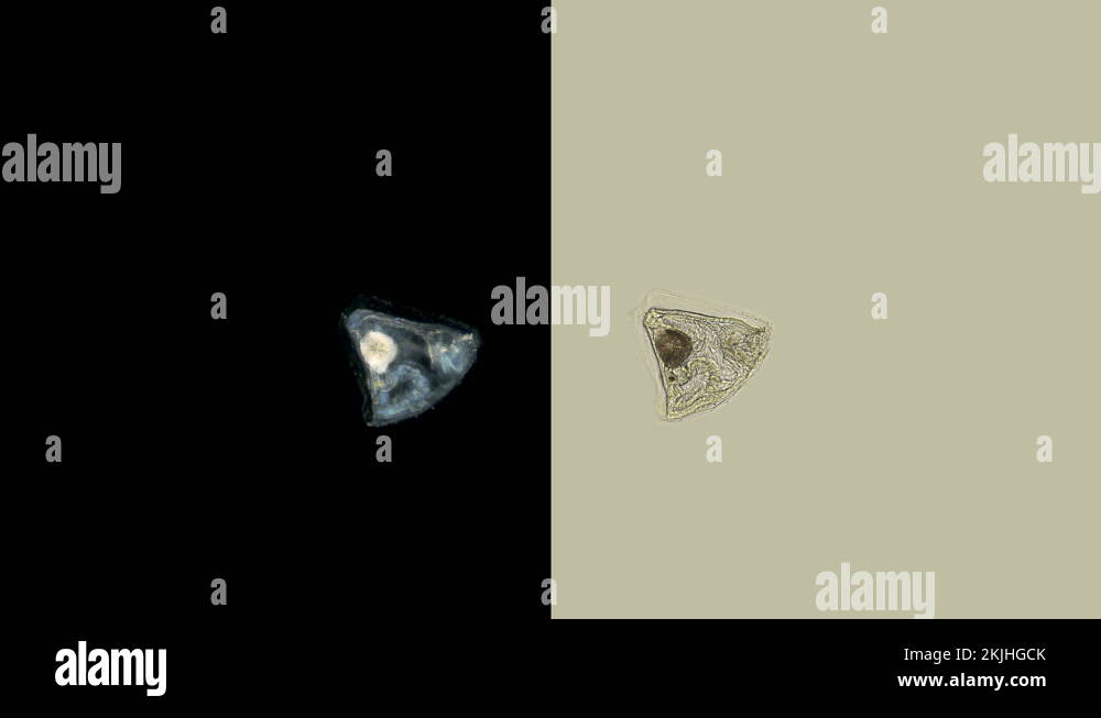 Larva of cyphonautes Bryozoa under the microscope, Clade Lophophorata ...