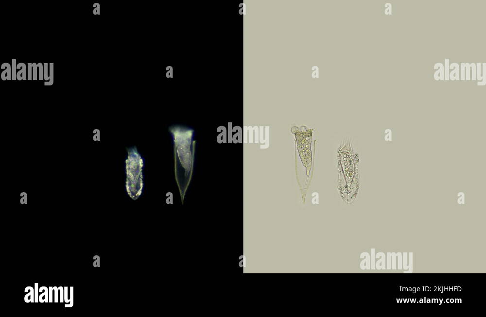 ciliates Parafavella sp. and Tintinnopsis sp. under the microscope ...