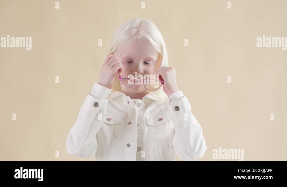 little fashion model, kid girl with abnormal deviations, unusual ...