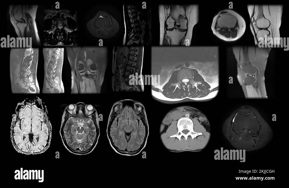 MRI scan timelapse of various sides human body, spine, bones organs ...