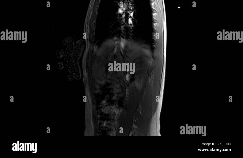 MRI scan timelapse of various sides human body, spine, bones organs ...