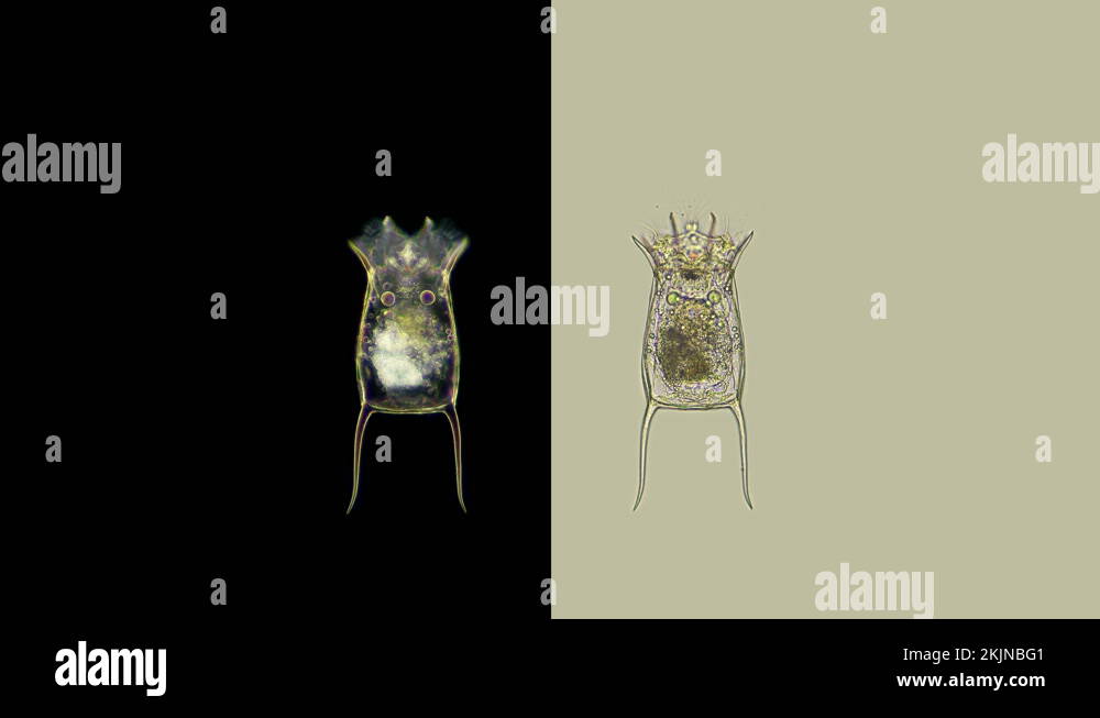 Rotifera Keratella Quadrata under the microscope, of the family ...