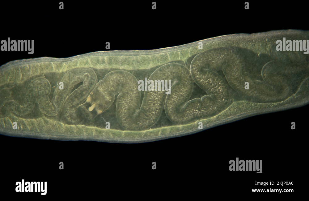 Worm Tetrastemma sp. under the microscope, Nemertea Phylum, vast ...