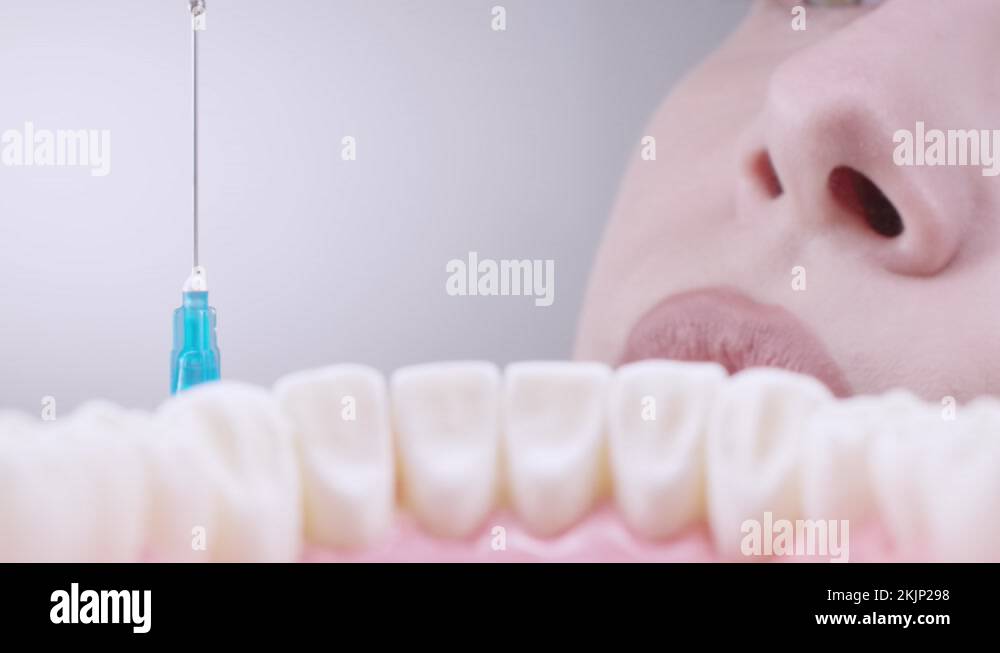 Dentist makes an injection for anesthesia Stock Video Footage - Alamy