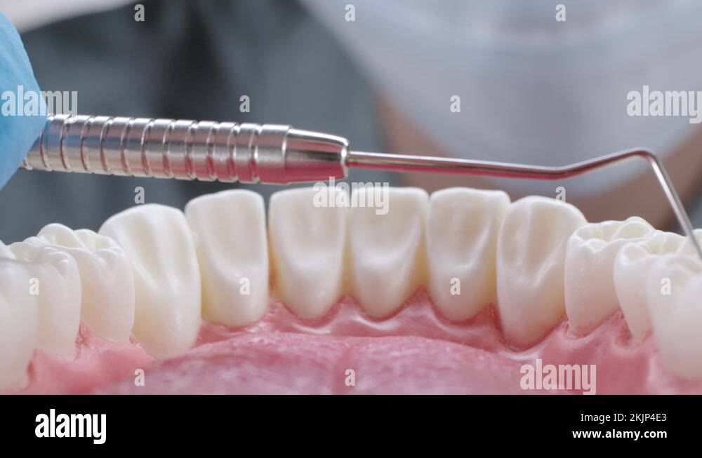 Inspecting teeth Stock Videos & Footage - HD and 4K Video Clips - Alamy
