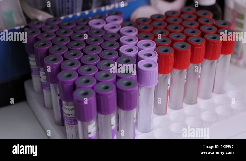 Vacutainer blood collection Stock Videos & Footage - HD and 4K Video ...