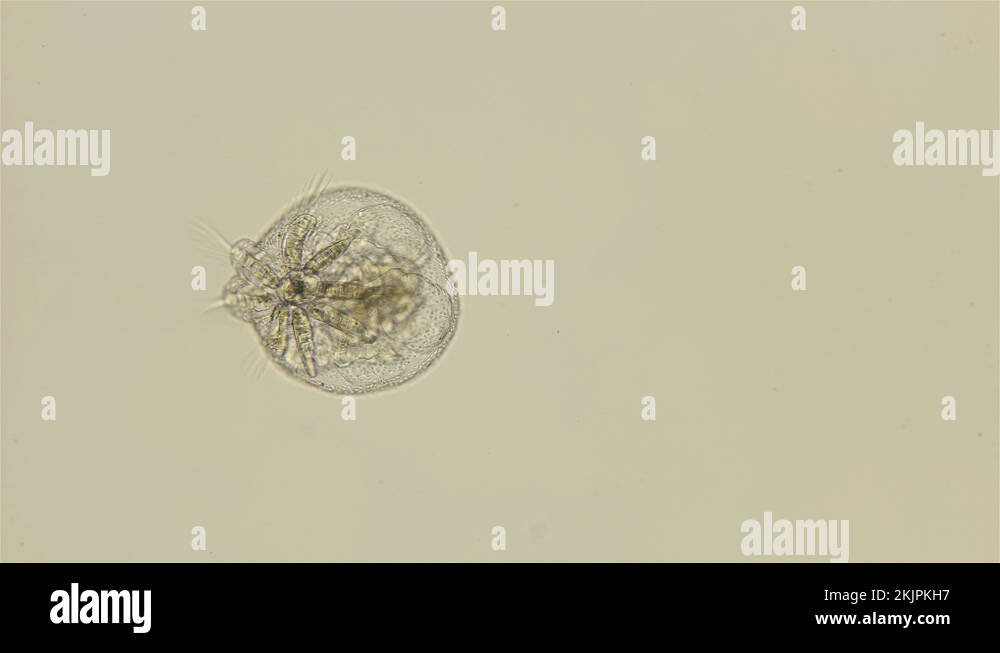 larva of Ctenophora Beroe ovata under a microscope, family Beroidae ...