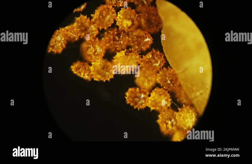 Pollen microscope tree Stock Videos & Footage - HD and 4K Video Clips ...