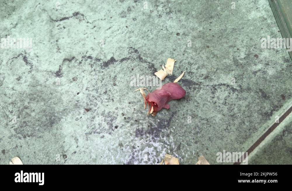 Fetus disease Stock Videos & Footage - HD and 4K Video Clips - Alamy