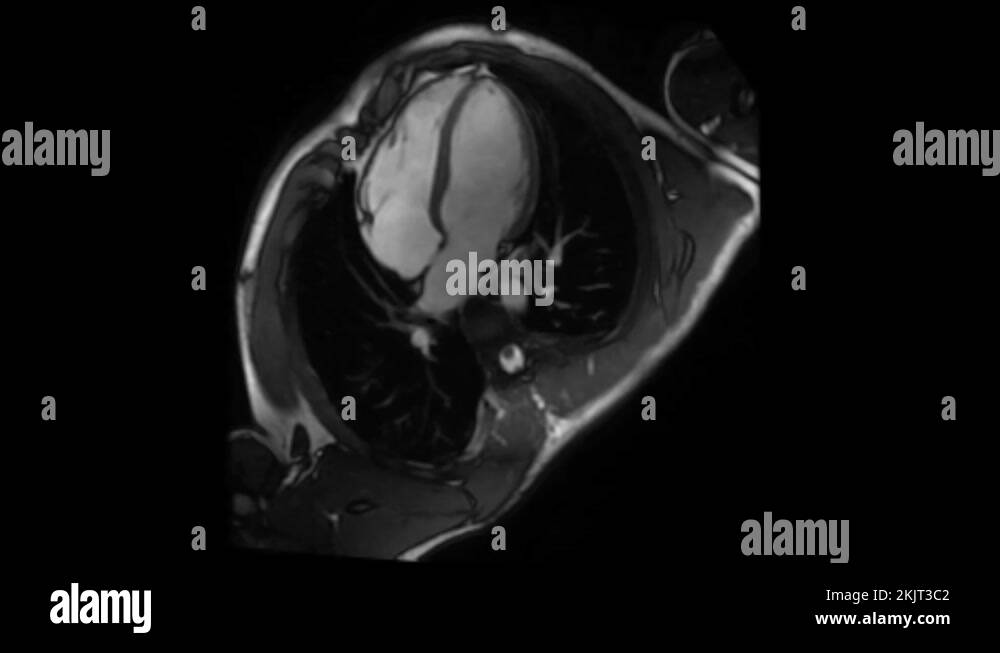 Real human heart Stock Videos & Footage - HD and 4K Video Clips - Alamy