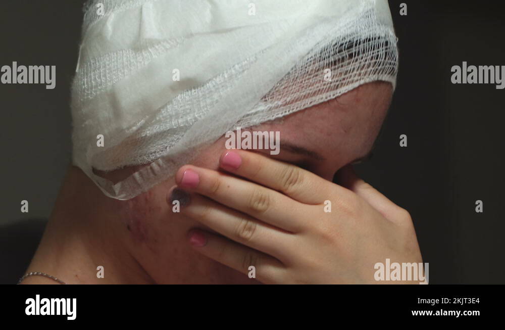 Woman bandaged head Stock Videos & Footage - HD and 4K Video Clips - Alamy
