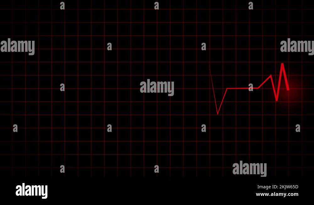 Human Circulatory System Heart Anatomy Animation Concept. Human ...
